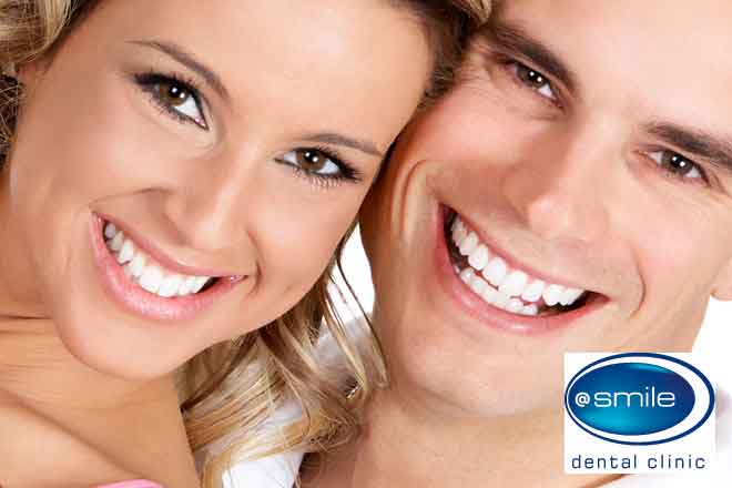 Professional Tooth Whitening from @smile dental clinic > Jersey Rewards